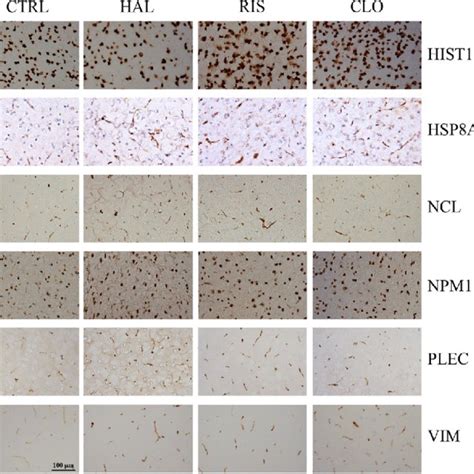 Immunohistochemical Staining Of The Rat Prefrontal Cortex Following