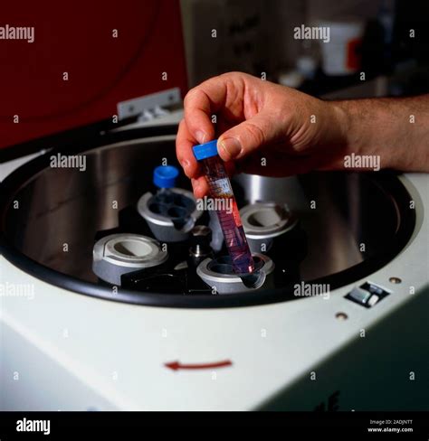 Sperm Concentration Hand Places A Tube Of Sperm In Fluid Into A Centrifuge During An In Vitro