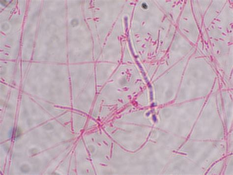 T Rubrum Micosaelmgi Flickr