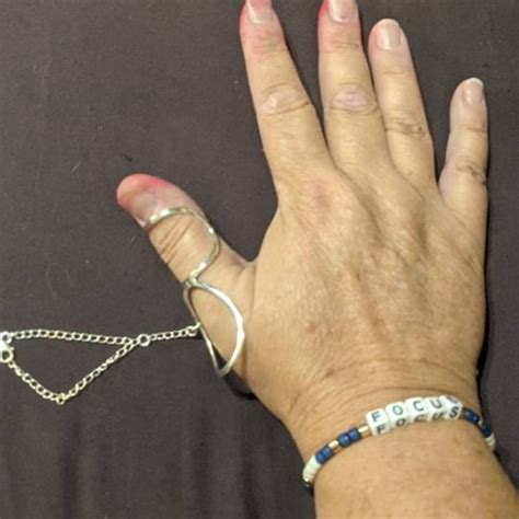 Arthritis Mcp Hyperextension Splint Ring Full Hand Support Splint Thumb