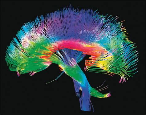 Human Connectome Project Maps Brain S Cortex Into 180 Distinct Compartments Genetic Literacy