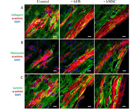 Niche Cell Supplementation Promotes Alignment Of Ecm Bundles With