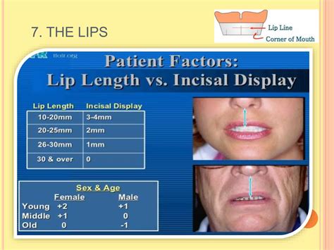 Teeth Selection For Cdpptx