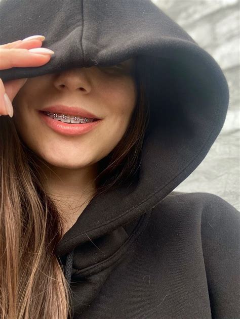 Pin By Olivia On Braces Cute Braces Braces Girls Braces Tips