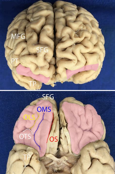 Orbitofrontal Cortex