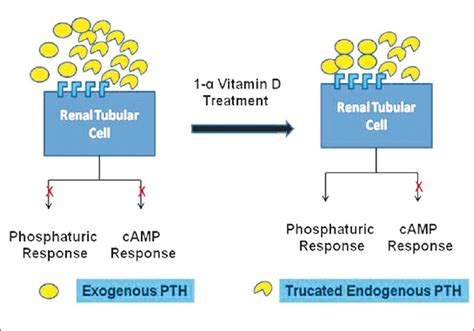 Adult Onset Pseudohypoparathyroidism Type 1b With Normal Phosphaturic Response To Exogenous