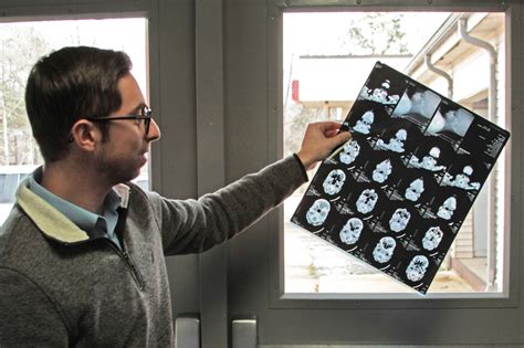 Upcoding Vs Downcoding Advize Health