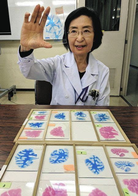 脳バンクで認知症に迫る 提供受けた脳を保存 愛知医科大こつこつ集め30年東京新聞デジタル