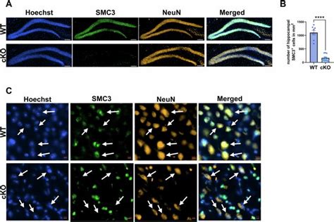 Sex Specific Modulation Of Anxiety Like Behavior By Forebrain Neuronal