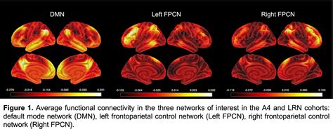 Functional Connectivity Of The Frontoparietal Control Network Is Positively Associated With