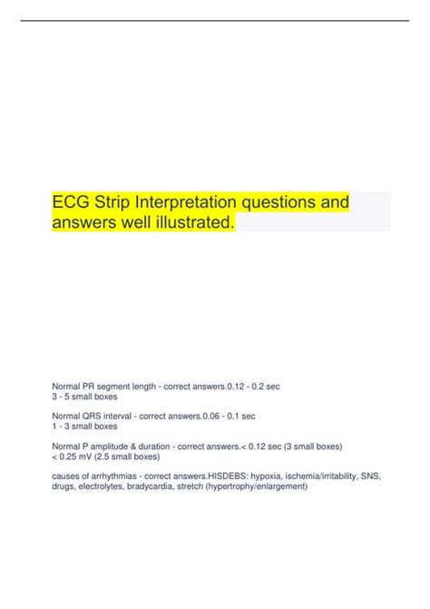 Ecg Strip Interpretation Questions And Answers Well Illustrated Ecg