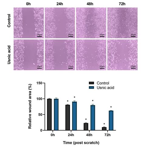 In Vitro Scratch Assay The Photos Were Taken 0 24 48 And 72 H