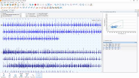 Interference Pattern Emg