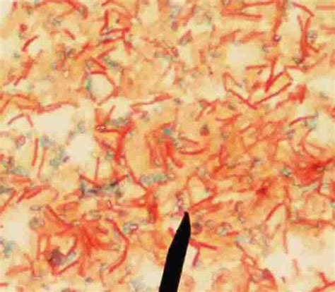 Bacterial Staining Microbiology Images Photographs And Videos Of Gram Acid Fast Endospore