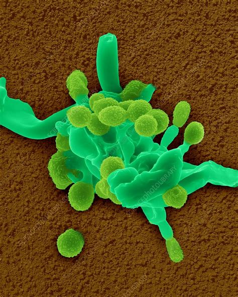 Powdery Mildew Mould Hyphae And Spores Sem Stock Image C032 3038 Science Photo Library