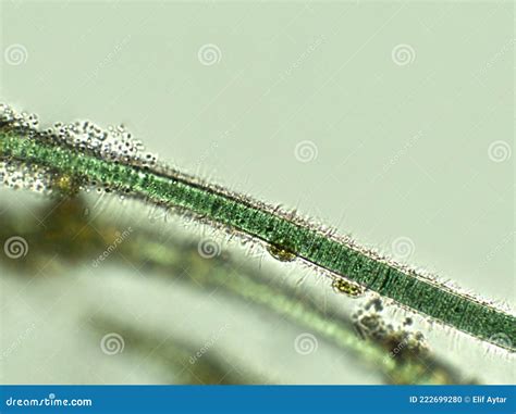 Blue Green Filamentous Algae Under Microscopic View Cyanobacteria Green Algae Oscillatoria Sp
