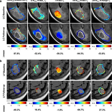 The QMRI Feature Heat Maps A The R Squared Heat Map Generated Using Download Scientific