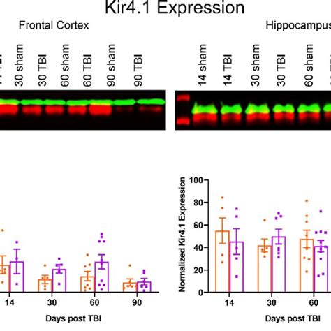 Morphology Of Electrographic Spontaneous Seizures Examples Of Download Scientific Diagram