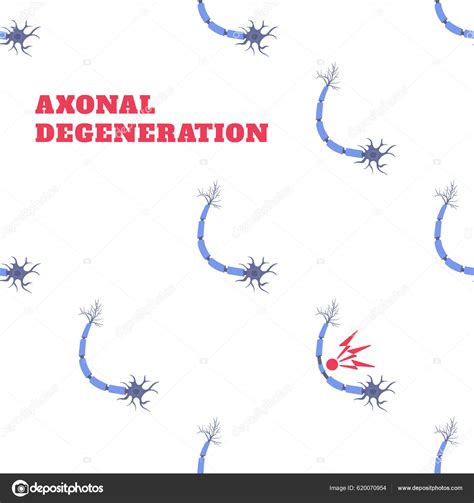 Axonal Nerve Degeneration Loss Communication Neurons Nad Disease Awareness Pattern Stock Vector
