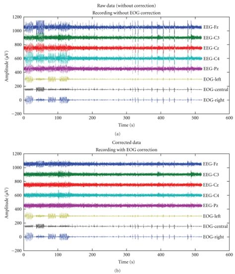 A Raw Eeg Data Contaminated With Ocular Artifacts B Corrected Download Scientific Diagram
