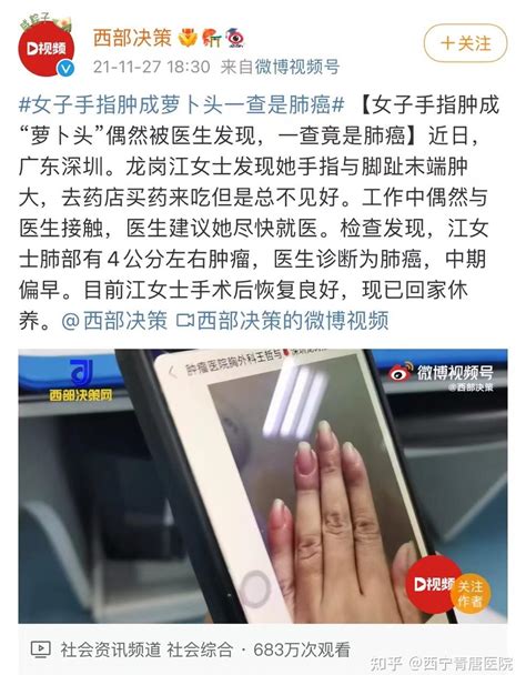 西宁青唐医院小课堂体内有癌指甲先知指甲出现2种变化不是大病就是癌千万别忽视这个不起眼的信号 知乎