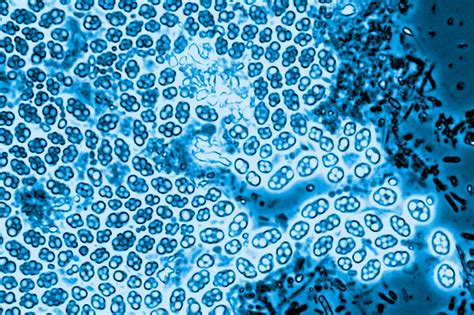 Paques Builds Pha Extraction Demo Plant In Northern Netherlands Agro