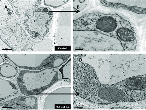 Effect Of La On The Subcellular Distribution Of Mitochondria In Download Scientific Diagram