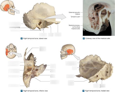 Temporal Bones Diagram Quizlet