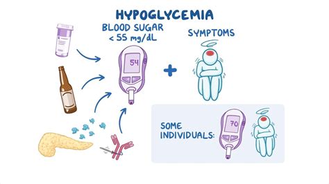 Video Approach To Hypoglycemia Clinical Sciences Osmosis