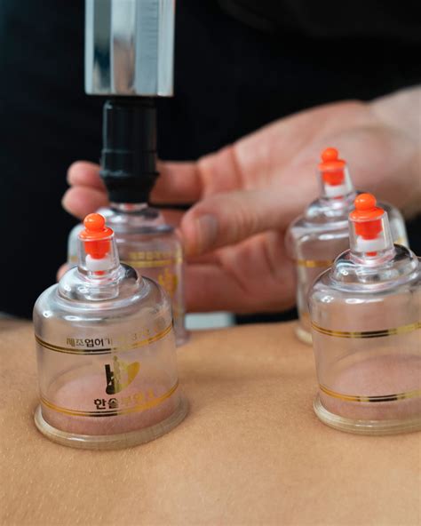 Myofascial Cupping In Hawthorn Elemental Osteopathy