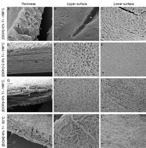 Sem Micrographs Of 3d Scaffolds [collagen] 6 Mg Ml With Different Download Scientific