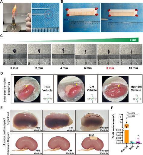 Illustration Of Modified Renal Subcapsular Transplantation Of Mouse Download Scientific Diagram