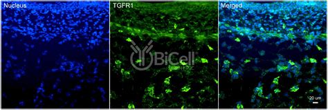 Tgfbr1 Tgfr1 Antibody Bicell Scientific®