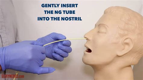 Nasogastric Ng Tube Insertion Osce Guide Geeky Medics