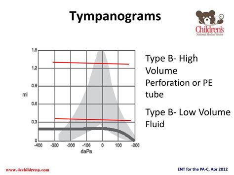 Tympanometry Test Type B At Raymond Eudy Blog