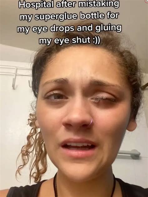 실수로 안약 대신 접착제 넣은 여성 눈 ‘이렇게 변해 당신의 건강가이드 헬스조선