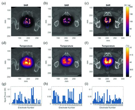 Three Dimensional Visualization Of The Patient Models With The Download Scientific Diagram