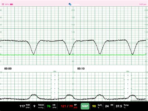 Settings Overview ISimulate