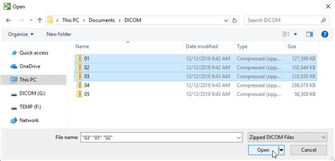 importing dicom zip archive