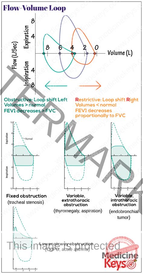 Flow Volume Loop Medicine Keys For MRCPs