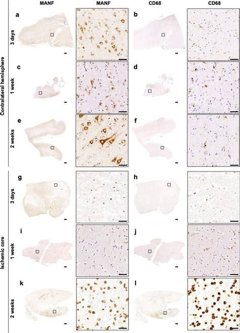 Jenni Anttila On Linkedin Manf Protein Expression Is Upregulated In Immune Cells In The Ischemic…