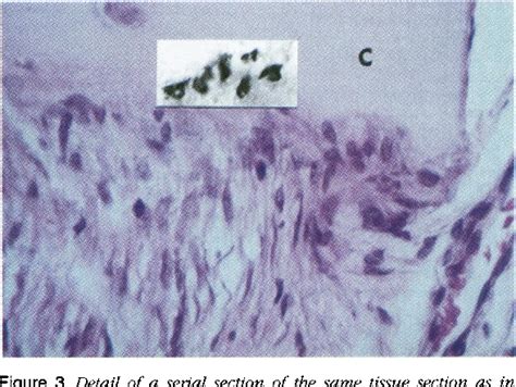 Figure 3 From Synovial Fibroblasts Of Patients With Rheumatoid Arthritis Attach To And Invade