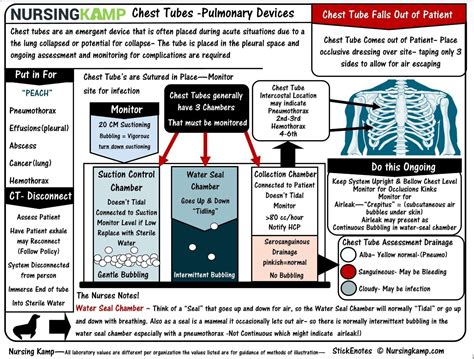 Chest Tube Cheat Sheet