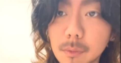 코 성형 실패한 男스타 6개월 후 재수술 팬들 걱정 ↑ [룩 재팬]