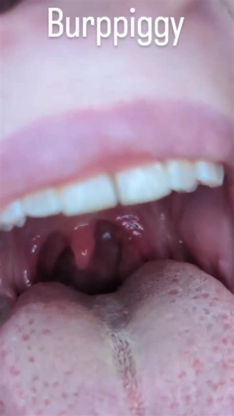Uvula Video ThisVid Com