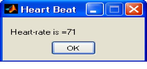 Figure From MATLAB Based ECG Signal Classification Semantic Scholar