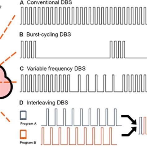 Exploratory Stimulation Patterns A Conventional Dbs B Burst Cycling Download Scientific