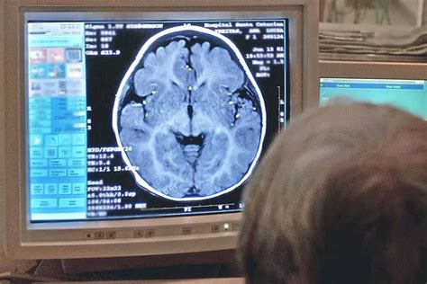 Why Penises SMILE During Sex And 5 More Weird Facts You Never Knew About Them Mirror Online