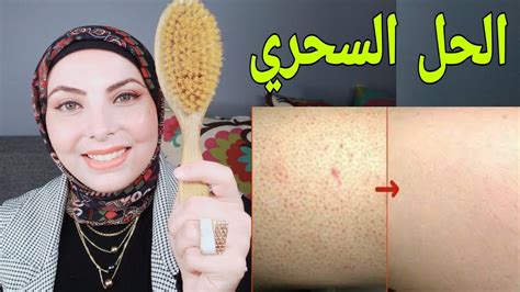 عايزة تتخلصي من جلد الوزة والشعر تحت الجلد والسلوليت وتفتحي المؤخرة