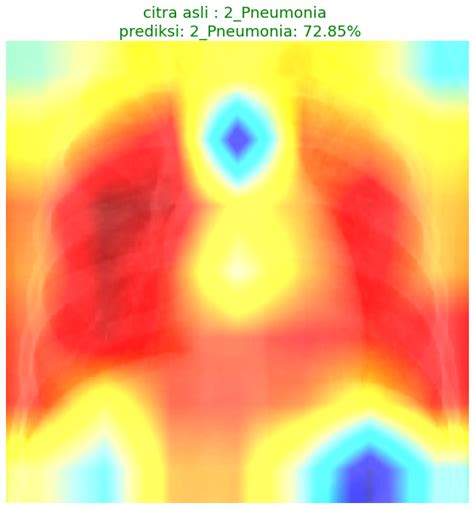 Grad Cam Exploration For Understanding The Inner Workings Of Convolutional Neural Networks By